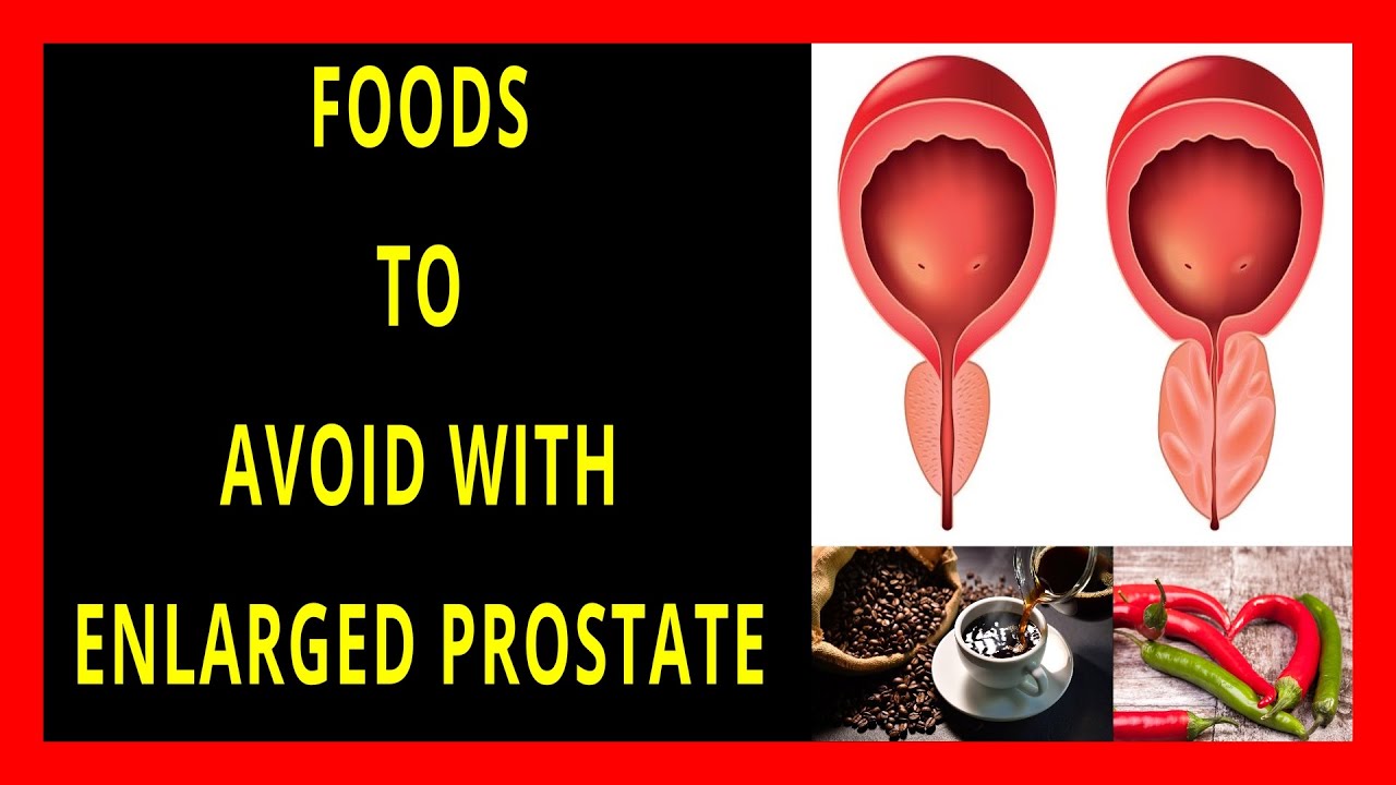Foods to Avoid if You Have an Enlarged Prostate | Reduce Symptoms ...