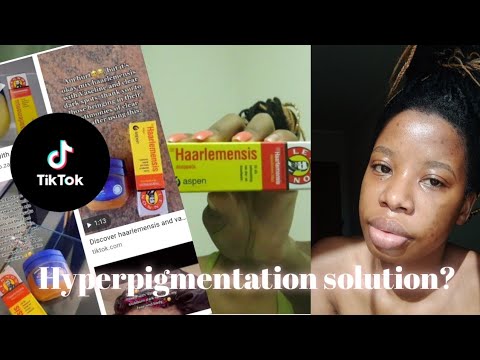 TIKTOK Haarlemensis and Vaseline hack for hyperpigmentation(acne scars ...