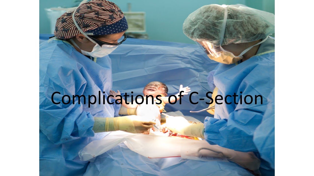 Complications of C-Section - YouTube