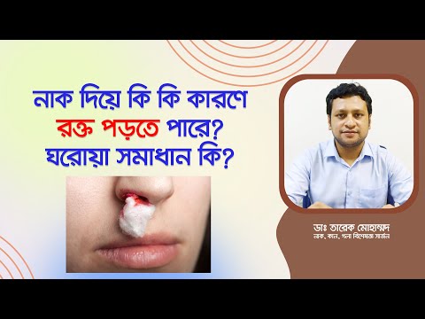 হঠাৎ নাক দিয়ে রক্ত পড়ার কতিপয় কারণ ও আমাদের করণীয়।