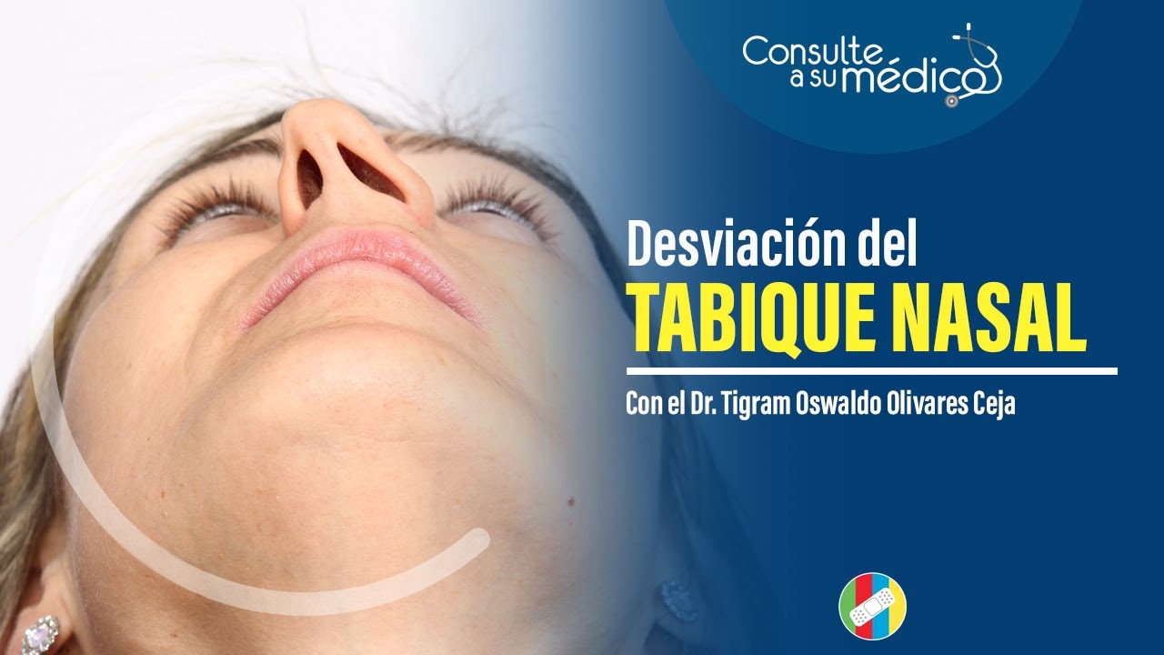 DESVIACION DEL TABIQUE NASAL - YouTube