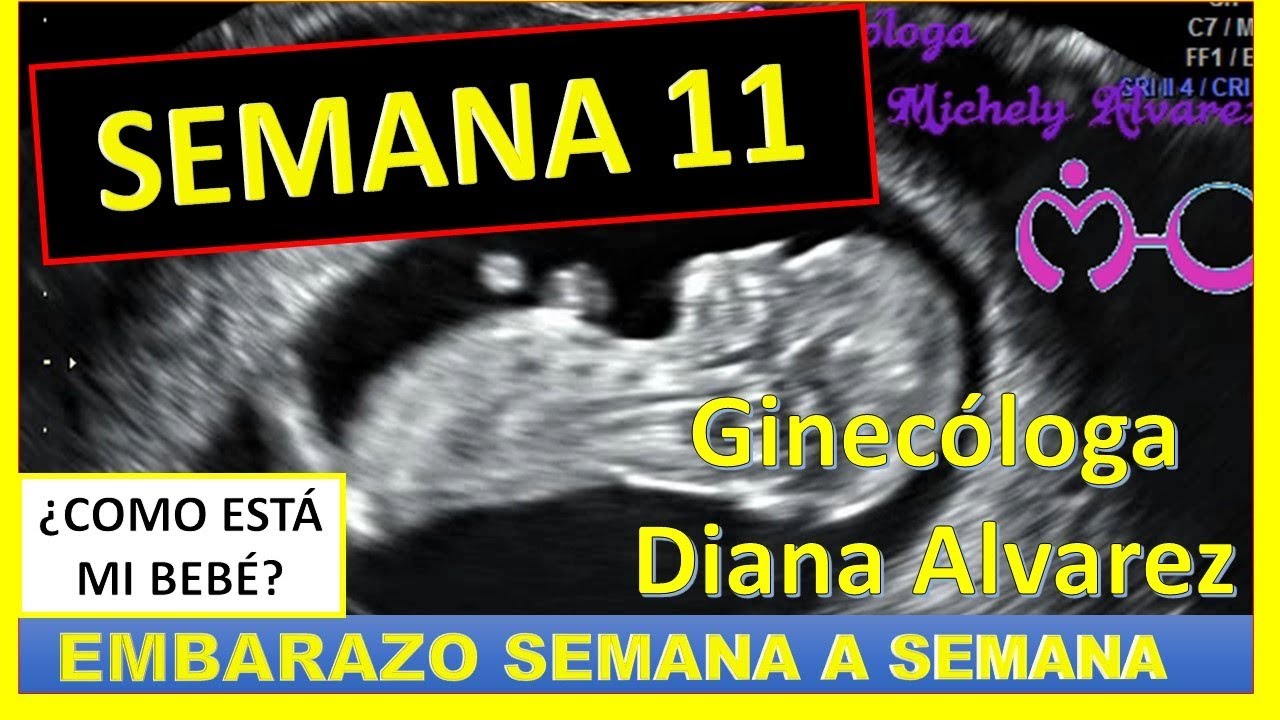 EMBARAZO SEMANA A SEMANA, SEMANA 11, POR GINECOLOGA DIANA ALVAREZ - YouTube
