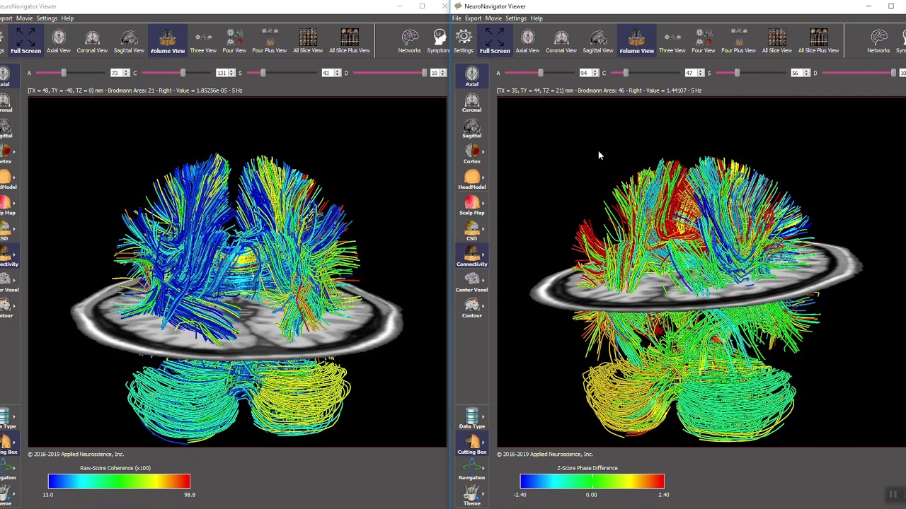 DTI Raw and Z Scores - YouTube