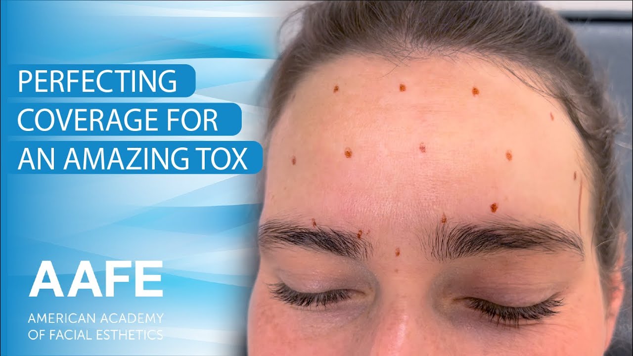 Perfecting Coverage for an Amazing Tox - YouTube