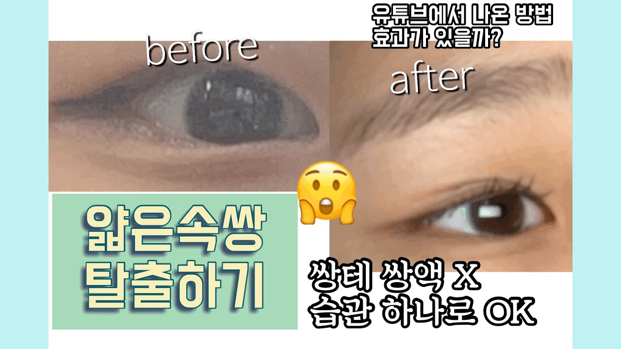 단시간에 쌍꺼풀 생기는 법 얇은 속쌍꺼풀 두껍게 만들기 쌍액쌍테 X Youtube