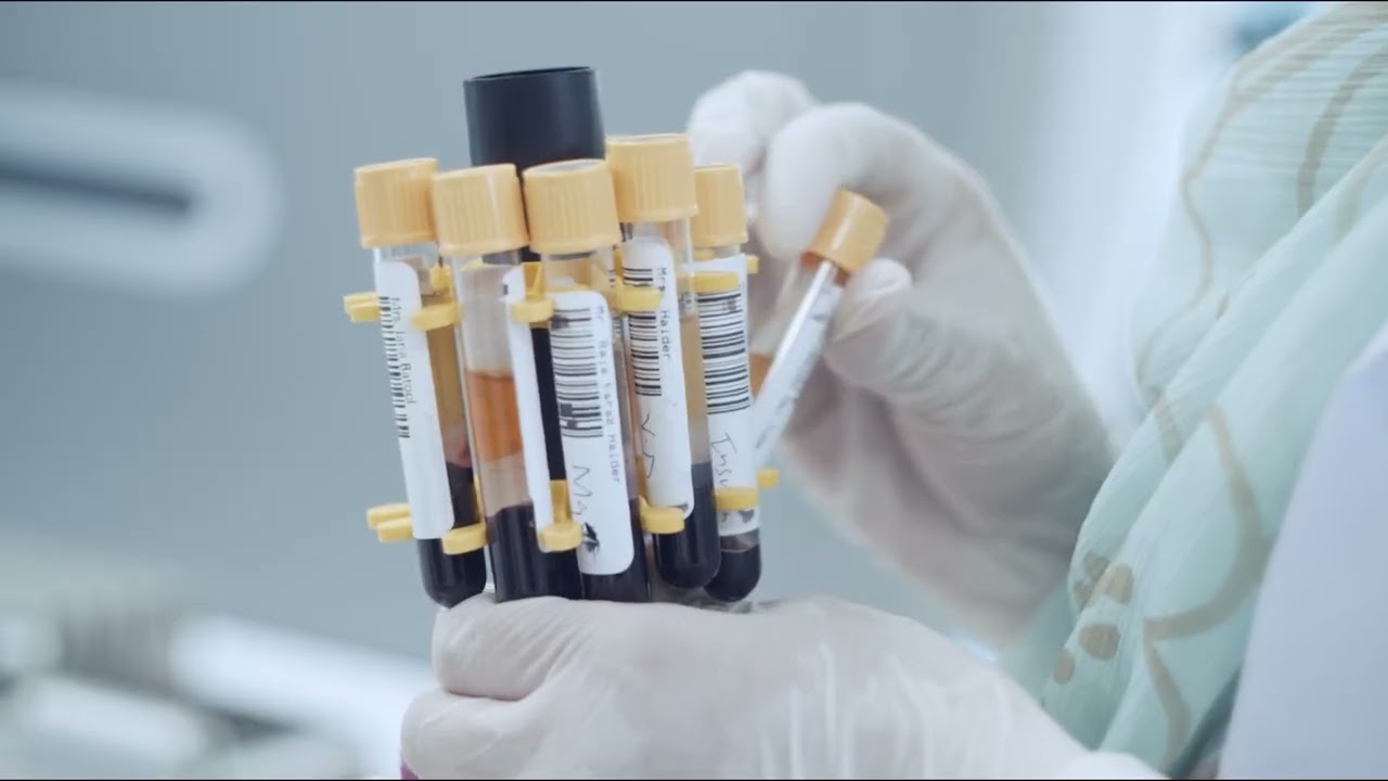 Total Lab Automation (TLA)-media - Best Diagnostic Center & Medical ...