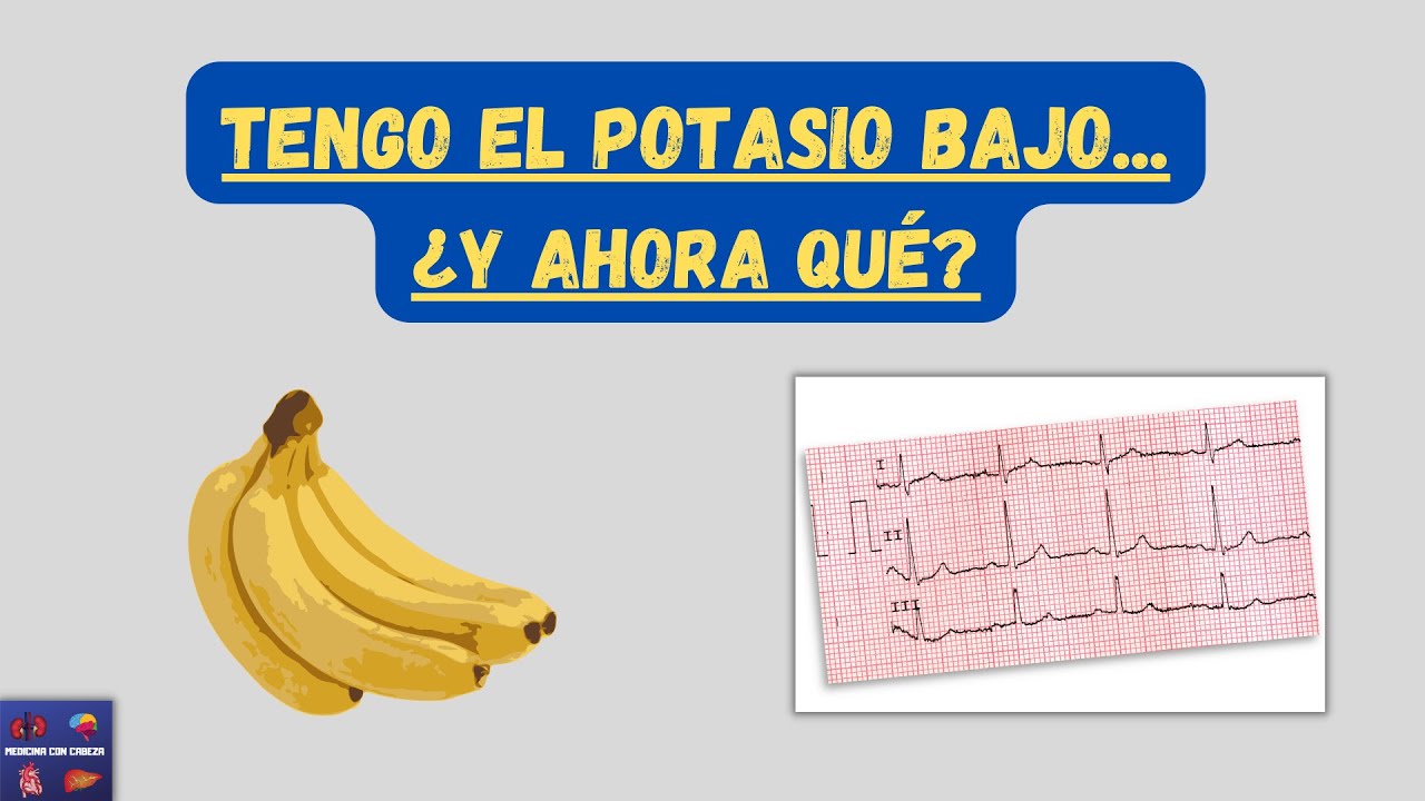 Hipopotasemia ¿qué Hacer 😥 Youtube
