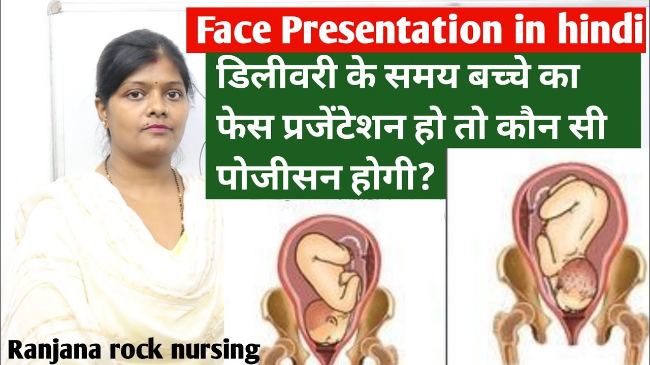 Face presentation lecture in hindi | lie, position & denominator ...