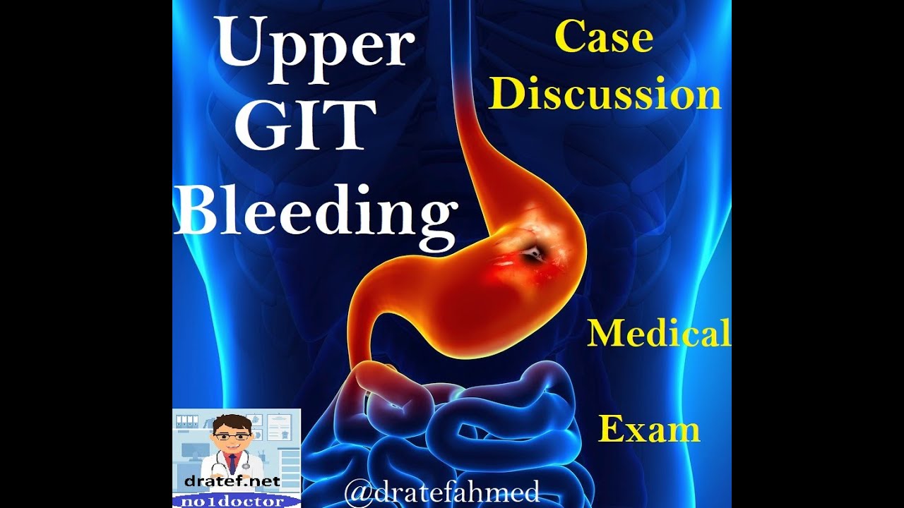 Upper GIT Bleeding / Medical Exam / Medical Case Discussion / Surgical ...