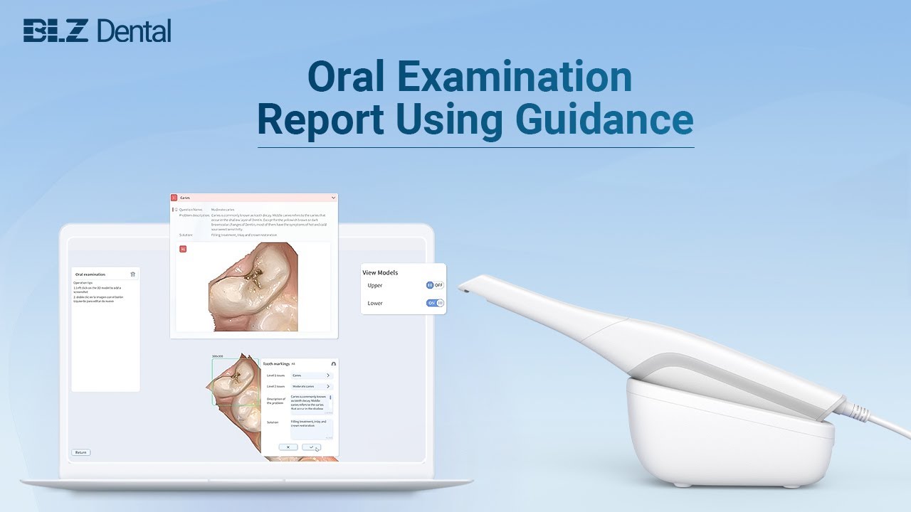 BLZ Dental Intraoral Scanner Oral Examination Report Using Guides - YouTube