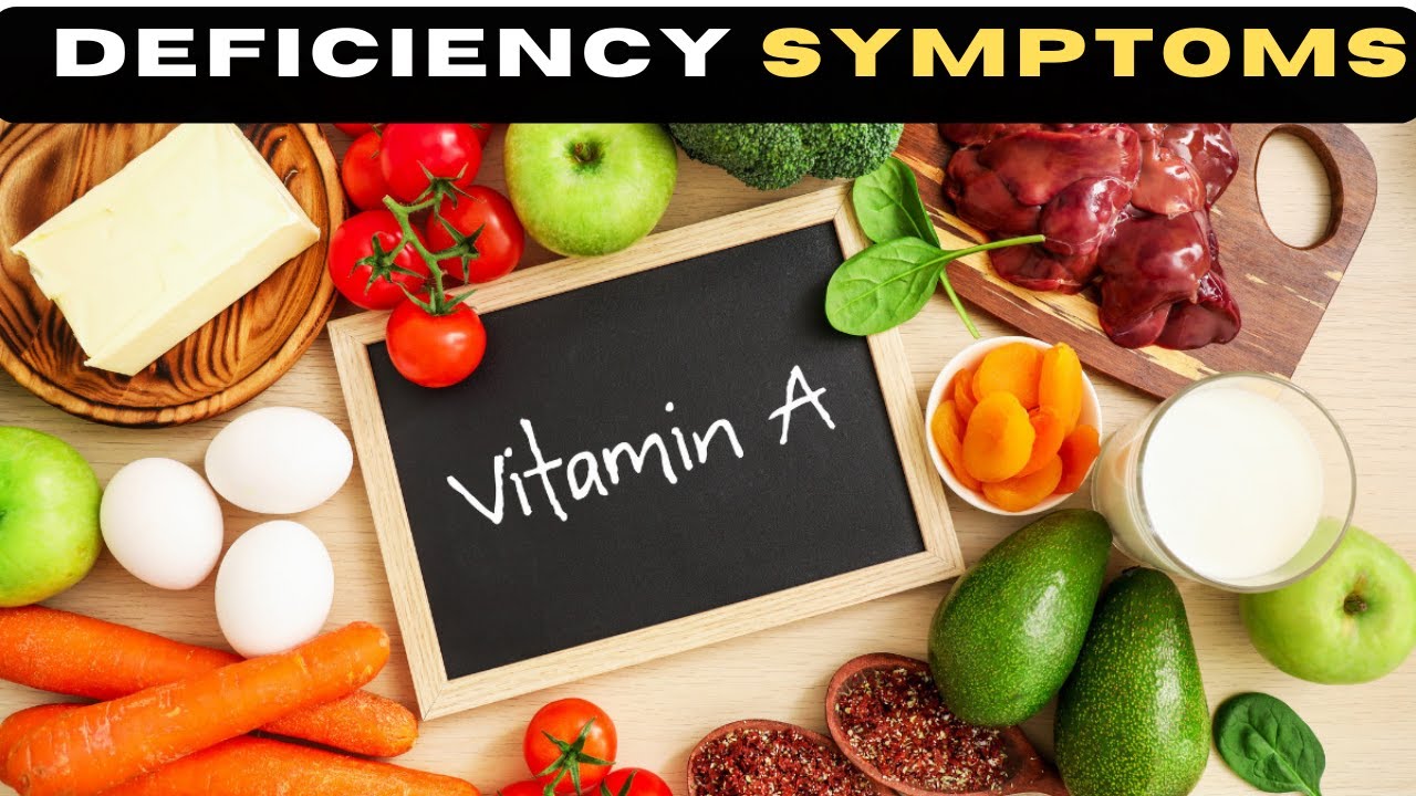 VITAMIN A DEFICIENCY SYMPTOMS || Top 10 Deficiency Symptoms of Vitamin ...