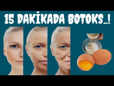 YUMURTA AKI YÜZÜNE BÖYLE SÜRDÜ /15 DAKİKADA CAM CİLDE KAVUŞTU/ KIRIŞIK GİDERİCİ BOTOKS MASKESİ #Cilt