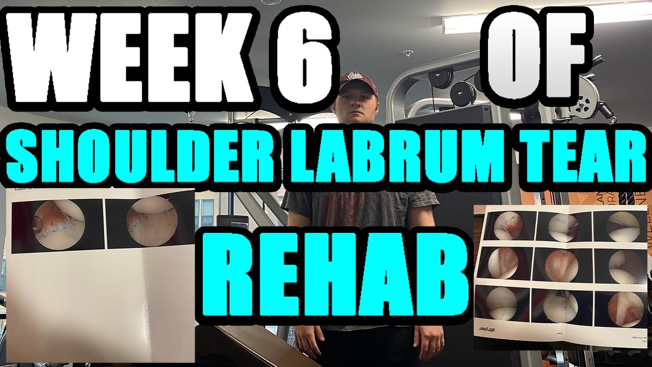 My Shoulder Labrum Tear Rehab (Week 6) - YouTube