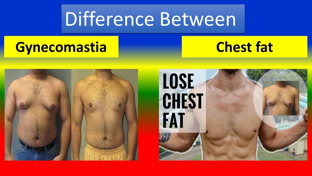 Difference between Gynecomastia and Chest fat - YouTube