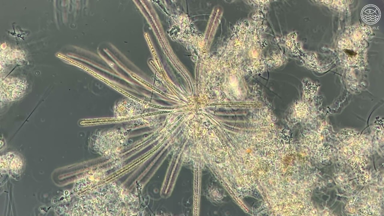 Roseta Thiothrix sp. en fangos activos - YouTube