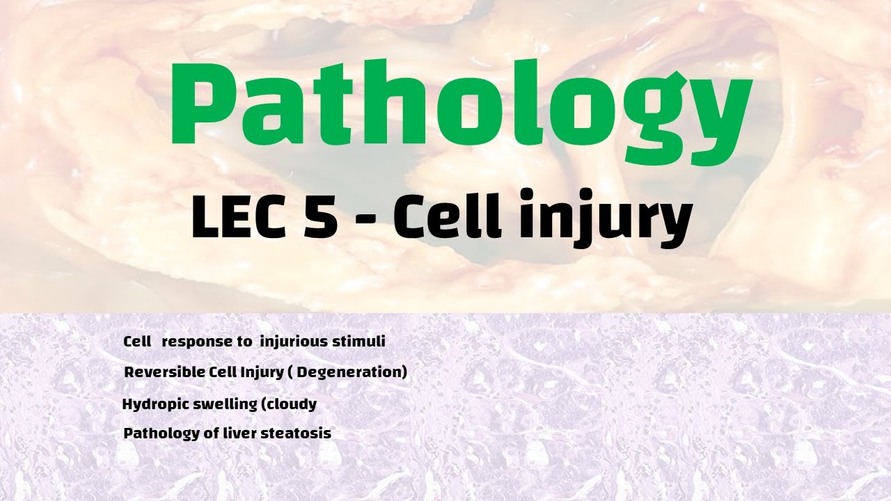 Pathology - LEC 5 - Cell injury - YouTube