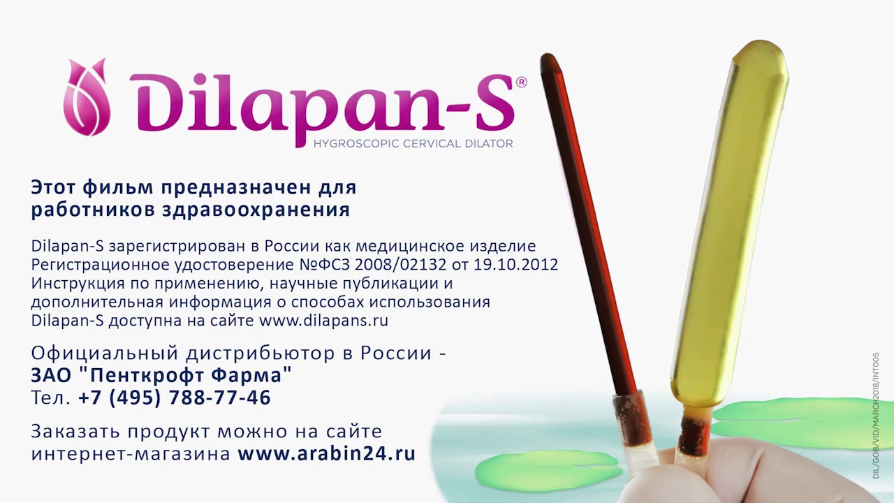 Dilapan S Дилапан Индукция родов обучающий фильм - YouTube