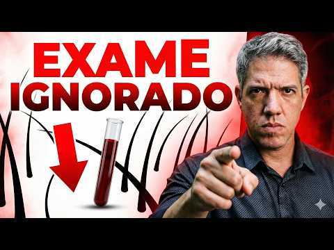 Seu Cabelo Está Caindo e Ninguém Investiga ISSO no Sangue (Ferritina Baixa)