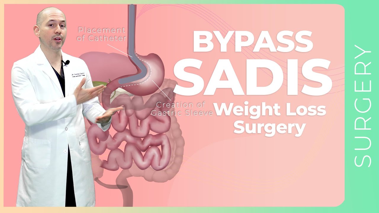 BYPASS SADIS What is it? How it works? | Surgery - YouTube