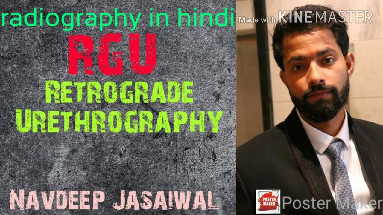Retrograde urethrography (RGU) ( radiography in hindi) - YouTube