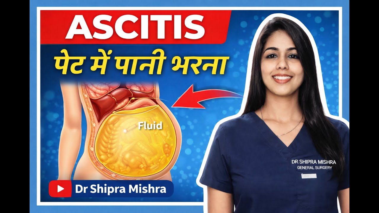 Ascites in hindi | ascites treatment | Ascites examination | - YouTube