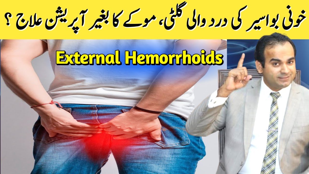 External Haemorrhoids | بواسیر میں درد والا موکا | Surgeon Dr Imtiaz Hussain - YouTube