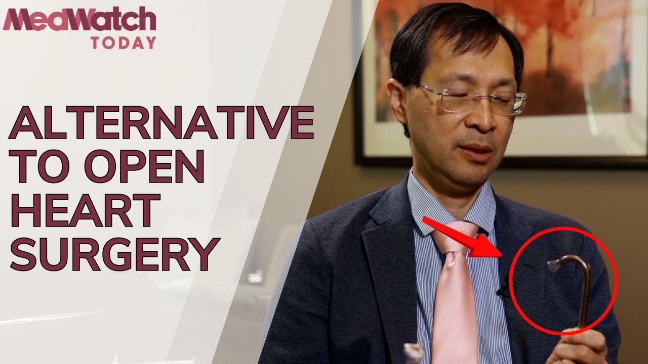 Removing Heart Blood Clots and Tumors with AngioVac - YouTube