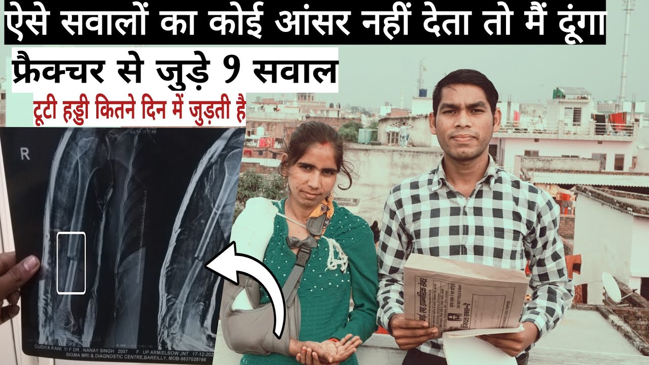 9 सवालों के उत्तर, fracture ke kitne din bad plaster katbana chahiye ...