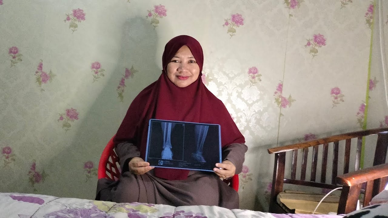 Hasil Rontgen ke-2 kaki saya‼️ - YouTube