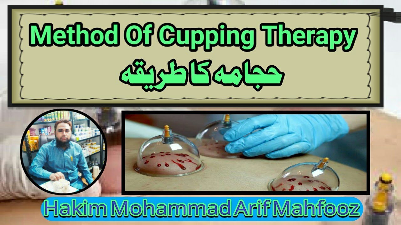 Method of cupping therapy - YouTube