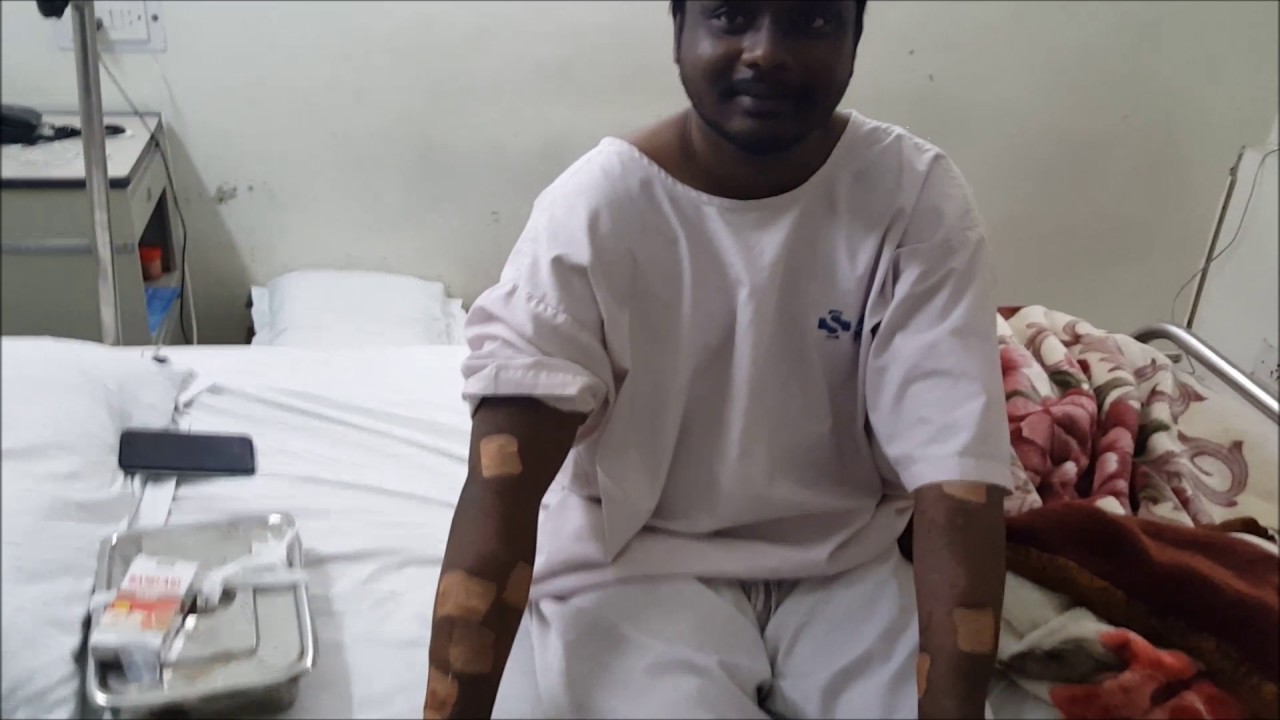 Multiple Lipoma Removal no Side Effects of Surgery - YouTube