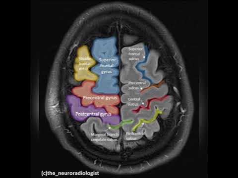 ANATOMY XRAY CT MRI - YouTube