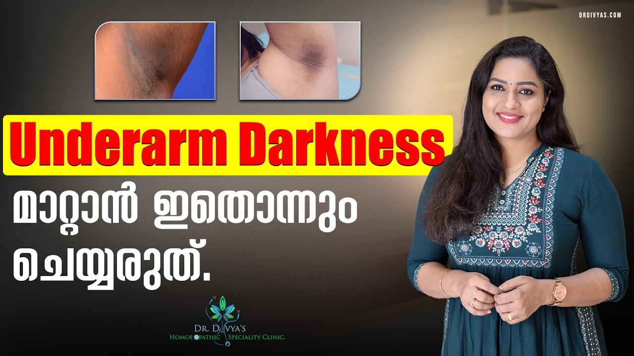 UNDERARM DARKNESS മാറ്റാൻ ഇതൊന്നും ചെയ്യരുത് How To Get Rid Of Dark ...