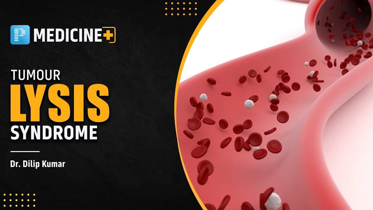 Tumor Lysis Syndrome [General Medicine] - Prepladder NEET SS - YouTube
