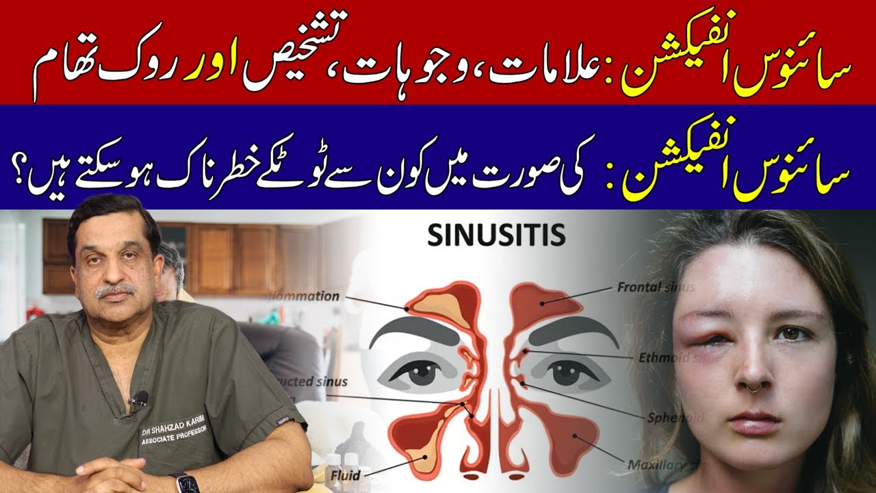 Remedies can be Dangerous in Sinus Infection?| Prevention and Diagnosis ...