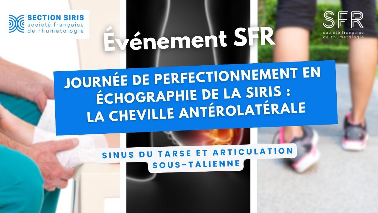 Cheville antérolatérale : Sinus du tarse et articulation sous-talienne ...