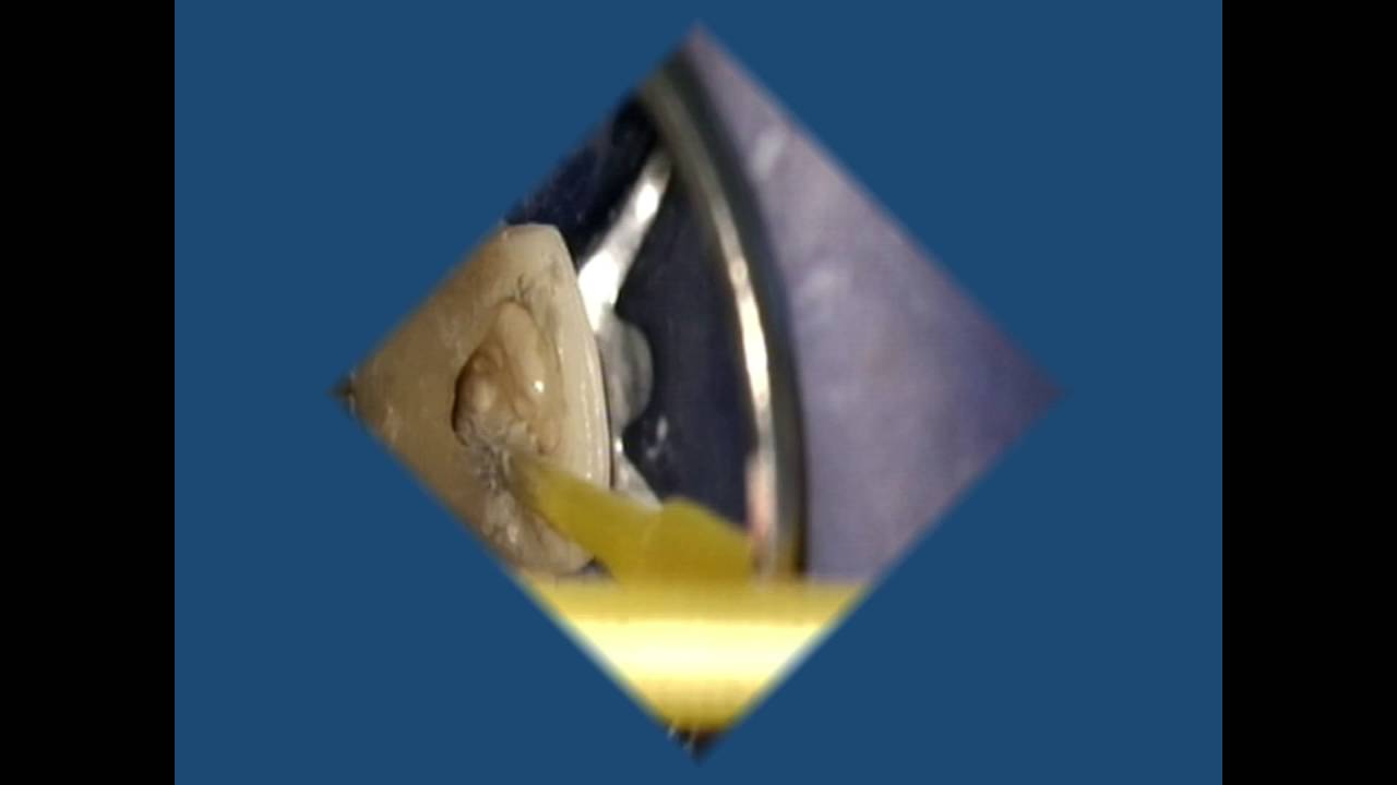 Open Apex Management - YouTube