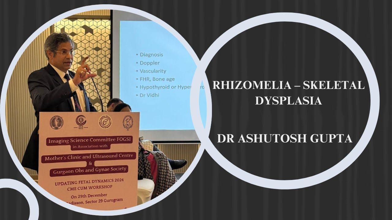 Rhizomelia – Skeletal Dysplasia - YouTube