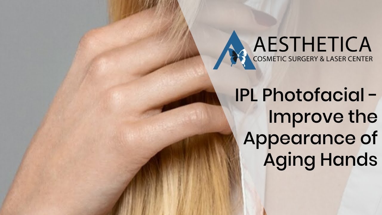 IPL Photofacial - Improve the Appearance of Aging hands - Phillip Chang ...