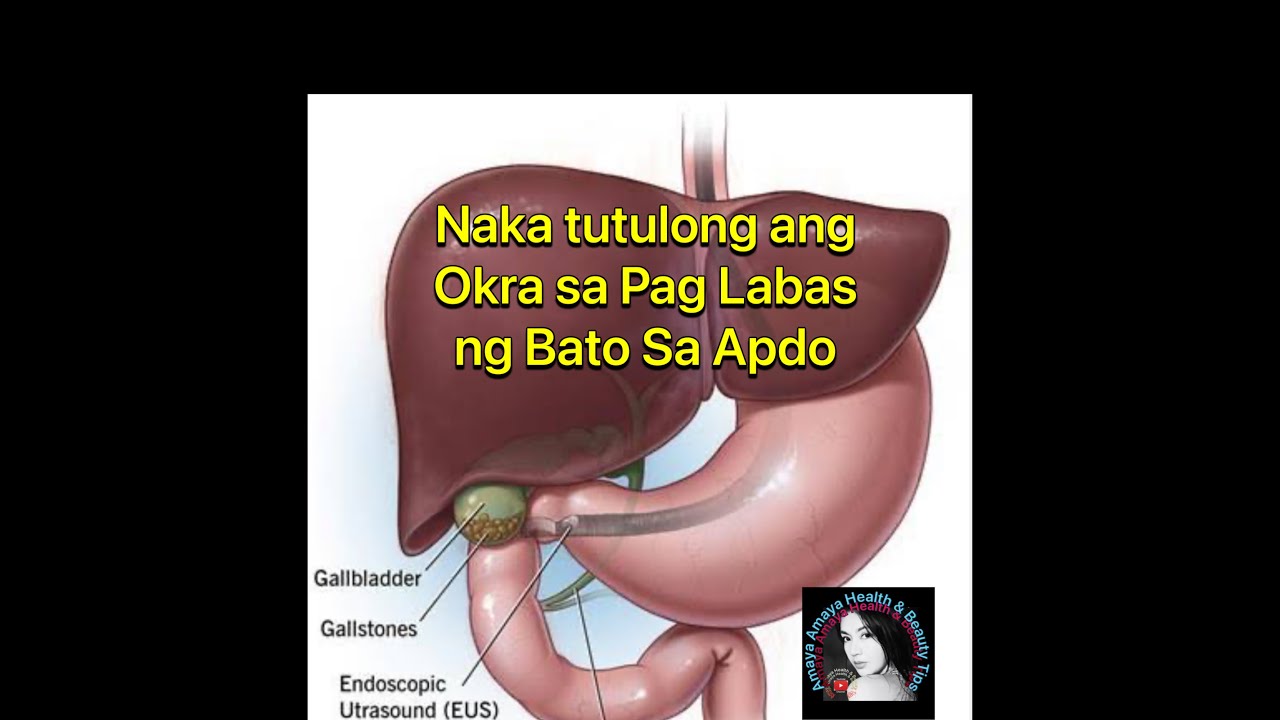 Mabilis Matanggal ang Bato sa Apdo sa Pagkain ng Okra Araw Araw - YouTube