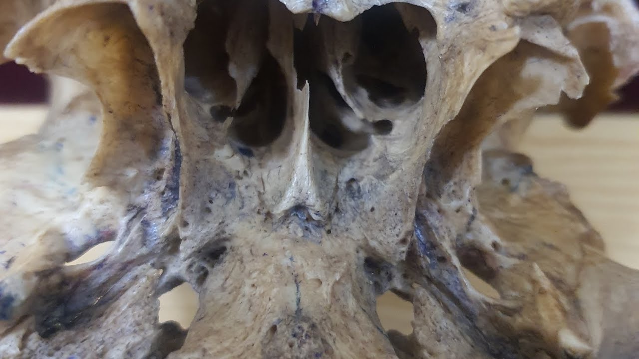 middle part of Norma Basalis ( skull)ii - YouTube
