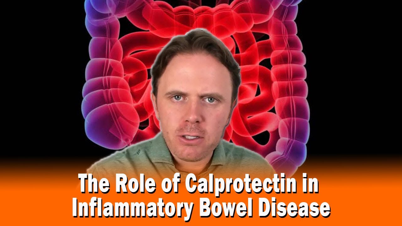 The Role of Calprotectin in Inflammatory Bowel Disease - YouTube