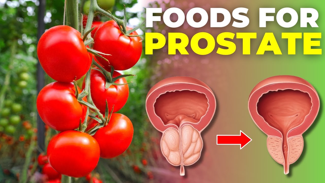 Top Foods for a Healthy Prostate: What to Eat - YouTube