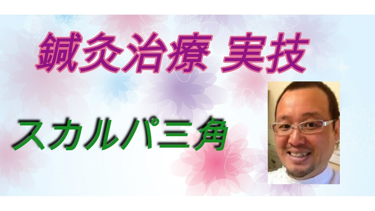 鍼灸治療 実技 How to acupuncture.Scarpa triangle.鼠径部の痛み、スカルパ三角 - YouTube