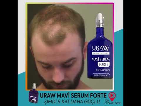 ÖLÜ SAÇI ANINDA CANLANDIRAN MUCİZEVİ SERUM
