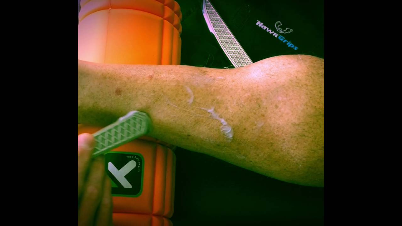 IASTM Technique on Calf Muscle - DeCou Sports Chiropractic - Bozeman ...