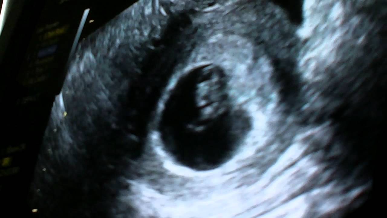 7 weeks 5 days - YouTube