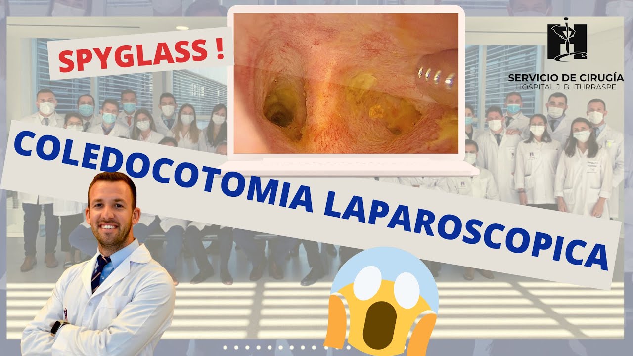 Coledocotomia O Que é - RETOEDU