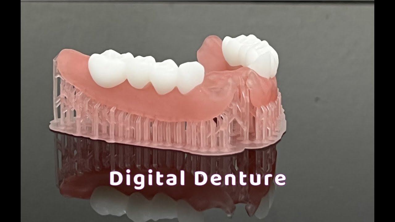 English Version / 3D Printed Digital Denture Post Processing / Glue ...