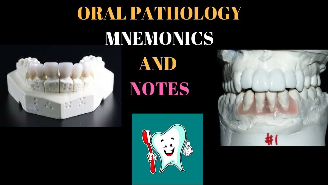 dental clinical mnemonic tricks - YouTube